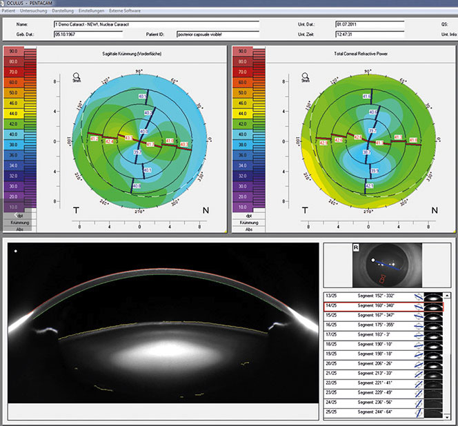 Surgery & Equipment | Retina & Macula | Cataract & Glaucoma